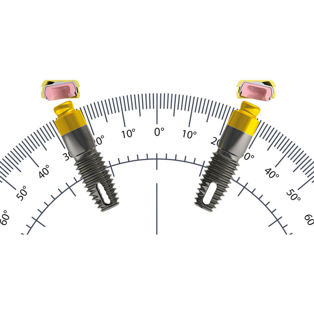 Rhein83 OT Equator Smart Box | Prestige Dental