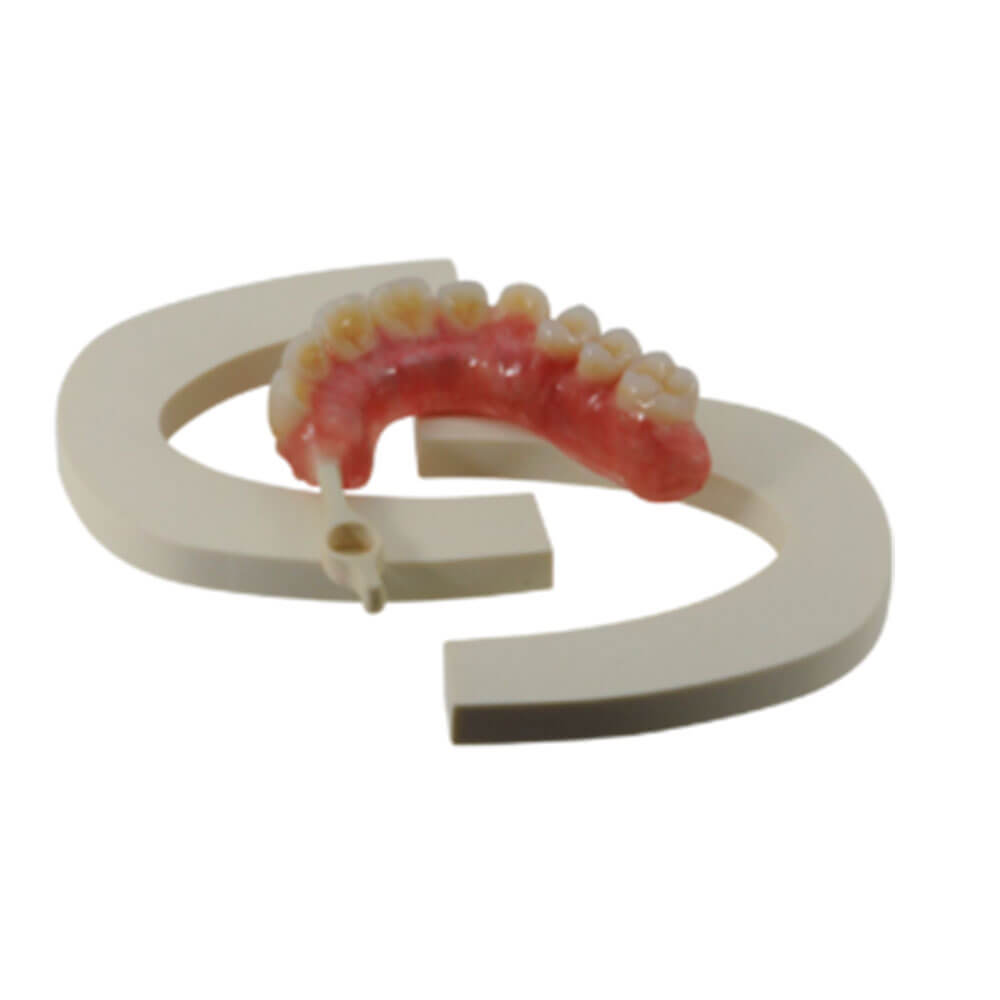 Trilor Arch | Prestige Dental
